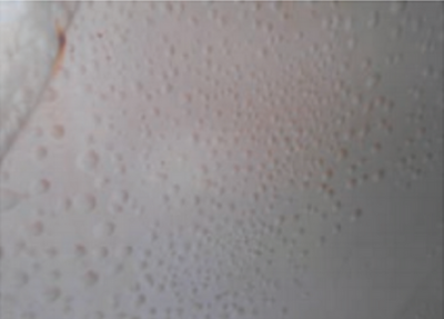 Blister Formation Definition | ViewTech Borescopes